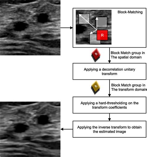 Breast Cancer Classification Based On Convolutional Neural Network And Image Fusion Approaches
