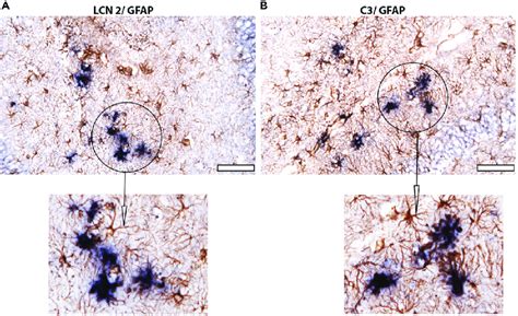Example Of Combined Ihc In Situ Hybridization Staining Combined Ihc In