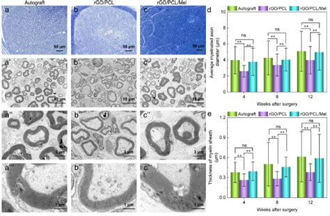 Figure 1 From 3d Printing Rgo Pcl Mel Bionic Conduit For Peripheral Nerve Regeneration