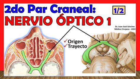 Quiasma Del Nervio óptico