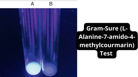 Optochin Susceptibility Test Principle Objective Procedure And