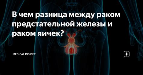 В чем разница между раком предстательной железы и раком яичек