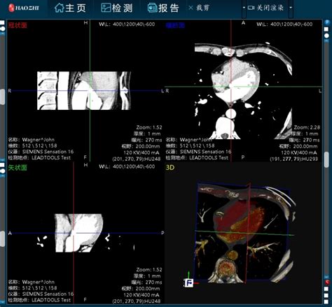 Mpr三视图阅片系统系统开发案例 程序员客栈