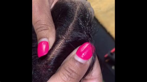 Bleaching Knots On Lace Closure Fully Detailed Youtube