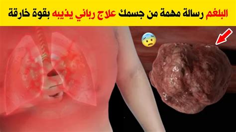 علاج كحة مع بلغم في الحلق والصدربطرق طبيعية ربانية دواء للكحة سريع