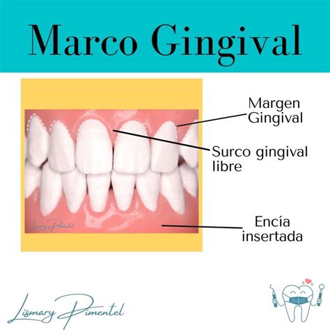 Marco Gingival Periodoncia Cosas De Enfermeria Odontología