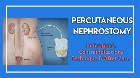 Percutaneous Nephrostomy Indication Contraindication Technique