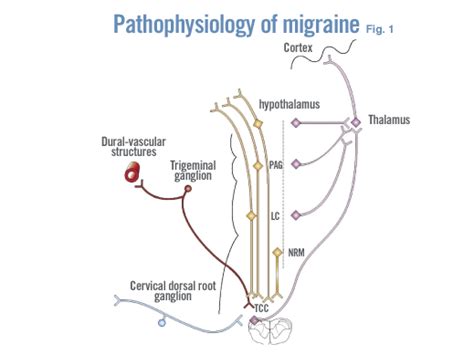 Pathophysiology Of Migraine