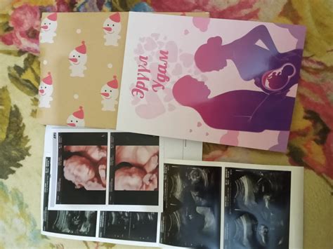 Жирэмсний 16 долоо хоногтойгоос ураг орчмын шингэний гол эх үүсвэр нь ургийн шээсээр бий болдог