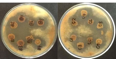 Growth Inhibition Of Actinomycetes Against Rhizoctonia Solani By Agar
