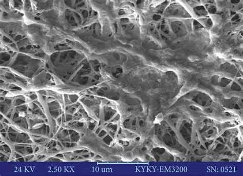 Poly L Lactic Acid Poly ε Caprolactone Plla Pcl Nanofibrous Scaffold Download Scientific