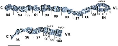 Photographic Map Of Salivary Gland Polytene Chromosome V Of Rhagoletis
