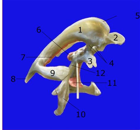Brain Ventricles Anterolateral Diagram Quizlet