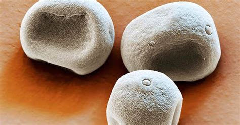 Pollen Grains Under Microscope Amusing Planet