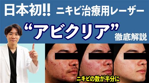 日本初！！ニキビ治療用レーザー【アビクリア】徹底解説！youtubeが配信されました！ 江坂駅前花ふさ皮ふ科・美容皮膚科｜吹田市の皮膚科