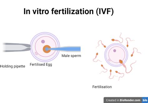 Ivf Definition Prevalence Procedure Risks Medications Sciencevivid