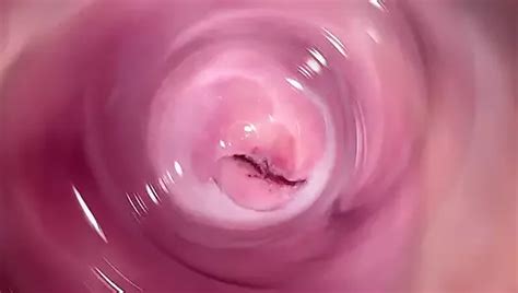 Internal Camera Deep Inside Mias Creamy Pussy Welcome To My Vagina