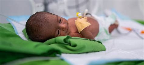In Babies Worldwide Are Born Preterm With Complications Un