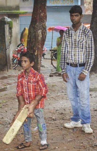 10 Gambar Budak Terkena Penyakit Tangan Gergasi Di India Harian Metro