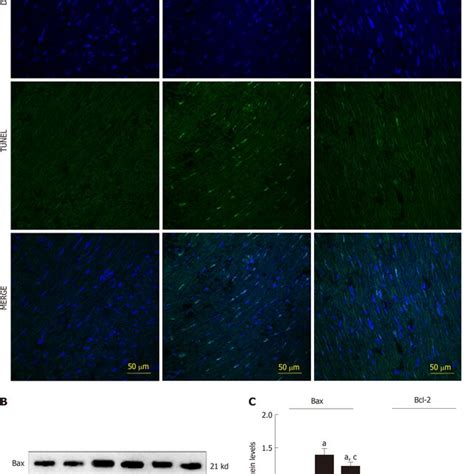 Effect Of Abdominal Paracentesis Drainage On Echocardiographic And