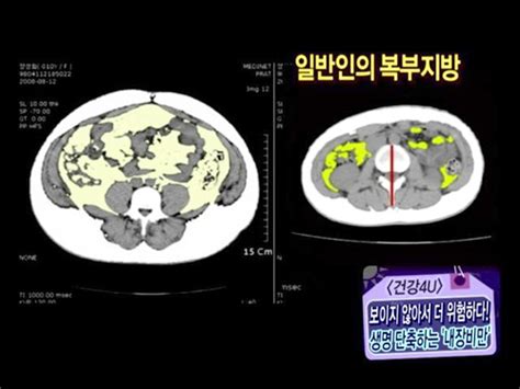 Instiz