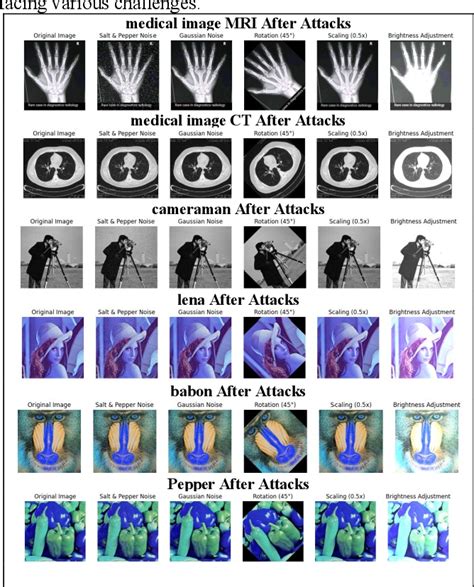 figure 1 from robust and secure watermarking of medical images using