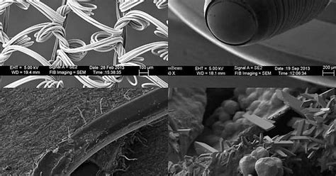 A Ball Point Pen A Staple Poking Through Paper And Coffee Grounds