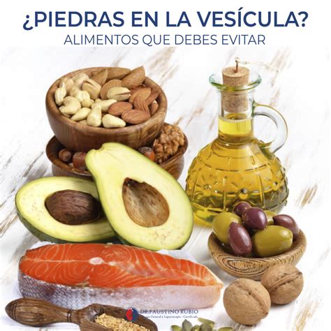 Alimentos Prohibidos Piedras En La Vesicula Speedworldhobao Es