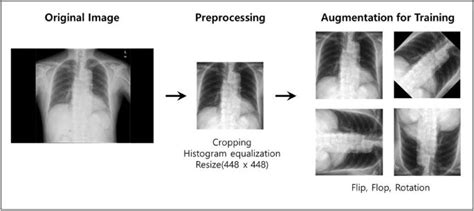 Reisel González Pérez On Linkedin Detection Of Acute Thoracic Aortic