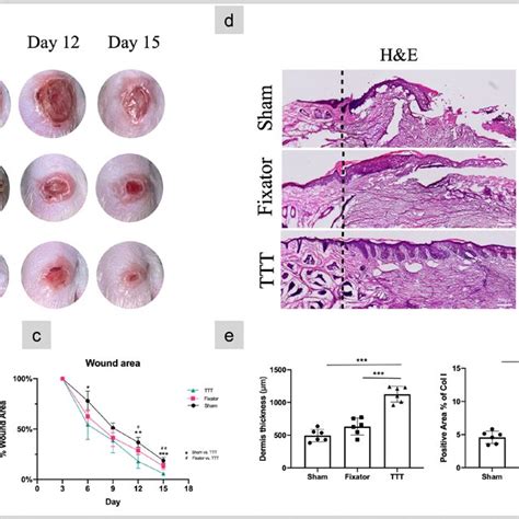Tibial Cortex Transverse Transport Ttt Technique Promoted Skin Tissue Download Scientific