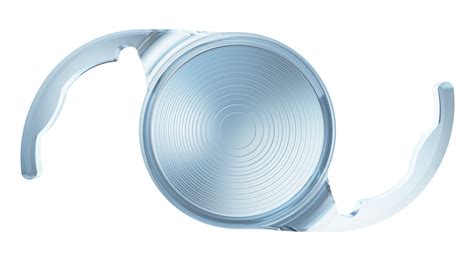 Presbyopia Correction In Cataract Surgery Maximizing Success And