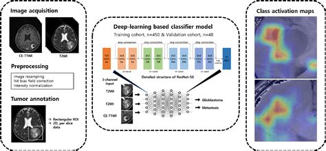 Figure 1 From Development And Validation Of A Deep Learning Based Model To Distinguish