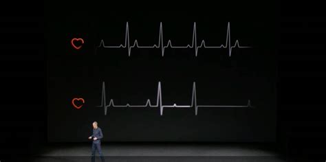 不只有iPhoneX苹果发布会上还有这款医疗级神器 健康 环球网