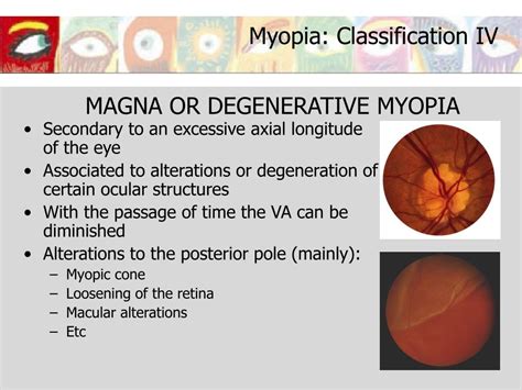 Ppt Myopia Powerpoint Presentation Free Download Id5459221