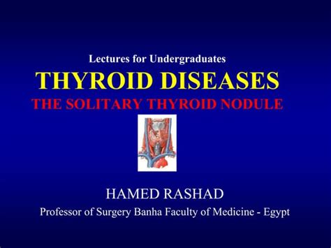 Thyroid Nodule For Undergrad The Lect Ppt