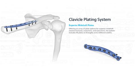 Medial Clavicle Acumed Information