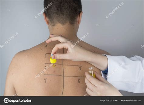 Allergist Laboratory Conducts Allergy Prick Test Skin Test Household