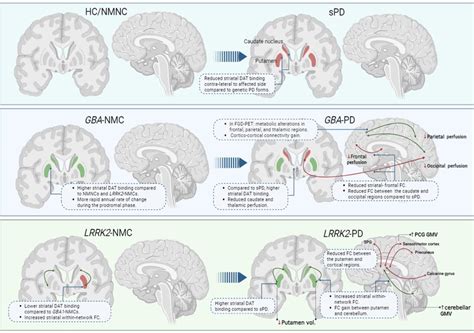 Graphical Summary Of Significant Imaging Findings From Nuclear Imaging