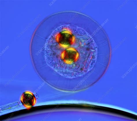 Shelled Amoeba Light Micrograph Stock Image C028 6409 Science