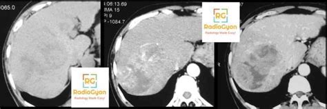 Radiology Spotters Cases Radiology Reources RadioGyan RadioGyan