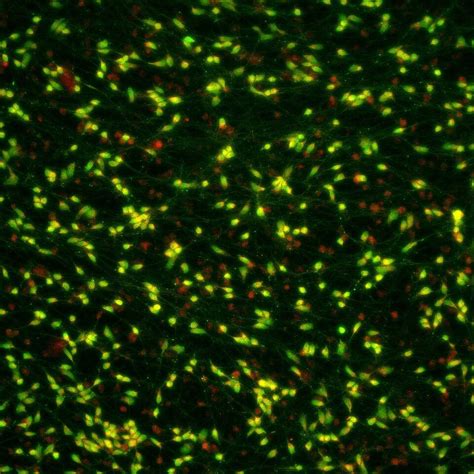 Behind The Paper Exploring The Neuroprotective Potential Of Nrf2