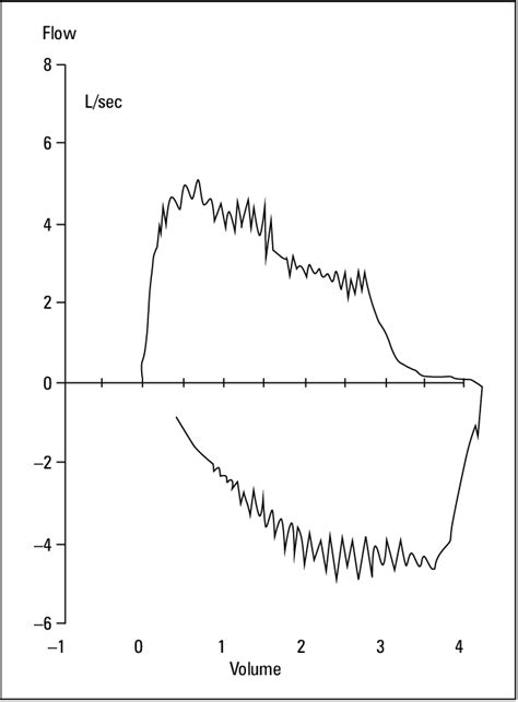 Flow Volume Loop Showing Inspiratory And Expiratory Flow Oscillations
