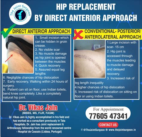 Hip Replacement Recovery Anterior Approach At Evie Rounsevell Blog