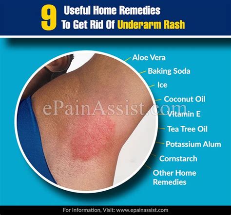 What To Do If I Have A Rash On My Armpit At Pauline Dane Blog