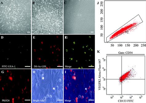 Identification Of Bone Marrow Derived Epcs A Adherent Cells Formed A Download Scientific