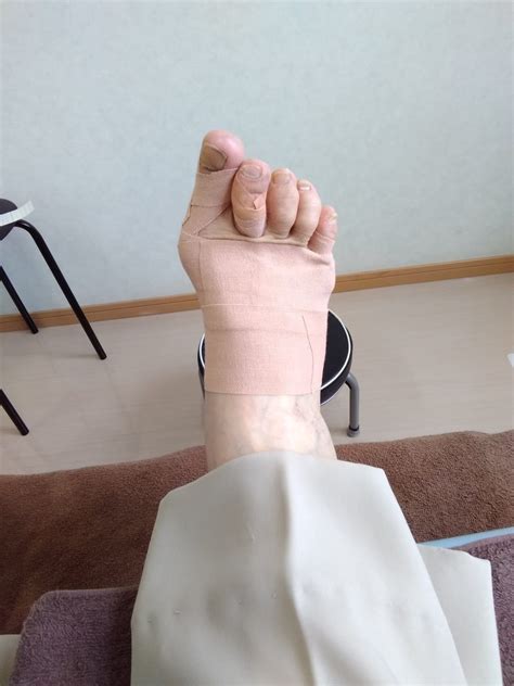 70代女性：スムーズに歩けるようになりました 症例実績 距骨調整navi