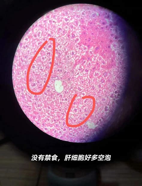 病理切片：肝脏和肠组织的关键步骤