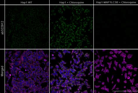 Anti Lc3b Antibody Epr18709 Autophagosome Marker Chicken Igy