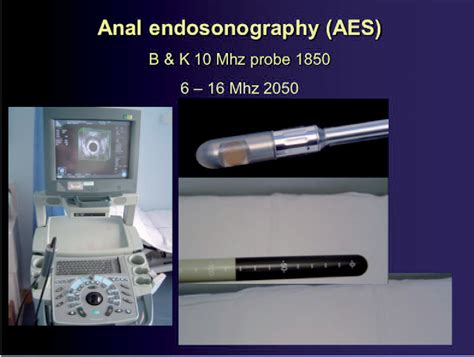 Figure 2 From Assessment And Treatment Of Obstructed Defecation Syndrome Semantic Scholar