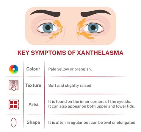 Your Eyes Can Show Signs Of High Cholesterol